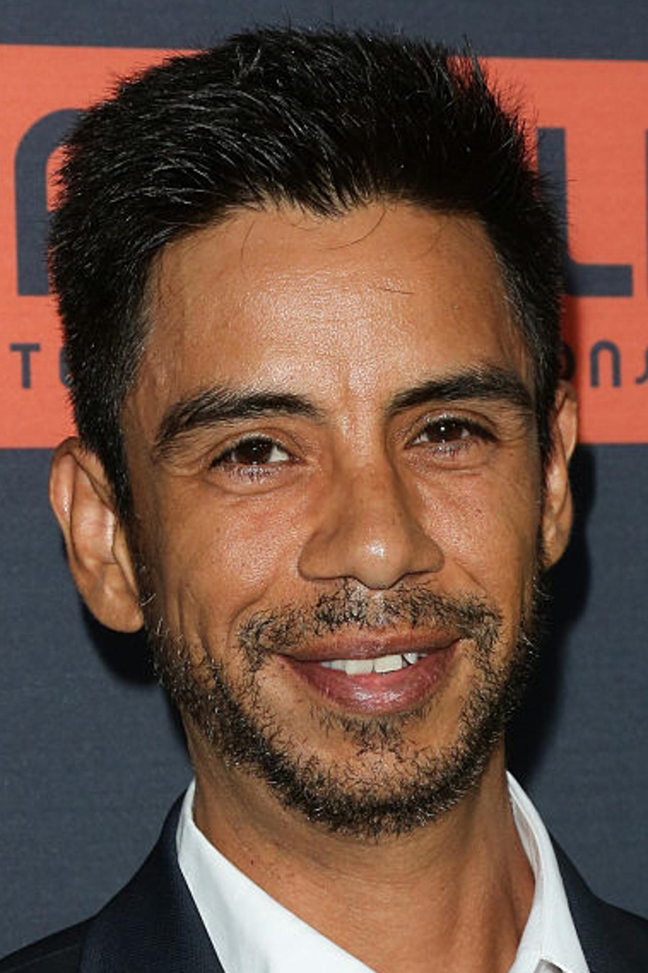 Hector Jimenez Teeth